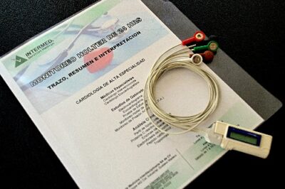 Holter De 24 Horas O Que Para Que Serve Como